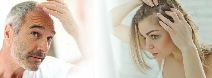 Hair Loss - Did you know that a healthy person can lose up to 100 hair ...